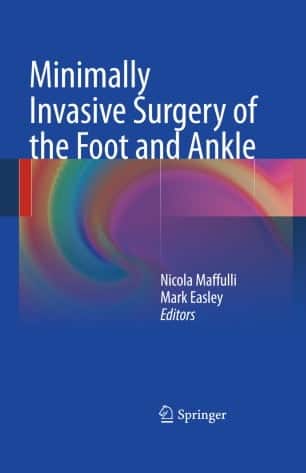 Minimally Invasive Surgery of the Foot and Ankle - physiolair.com