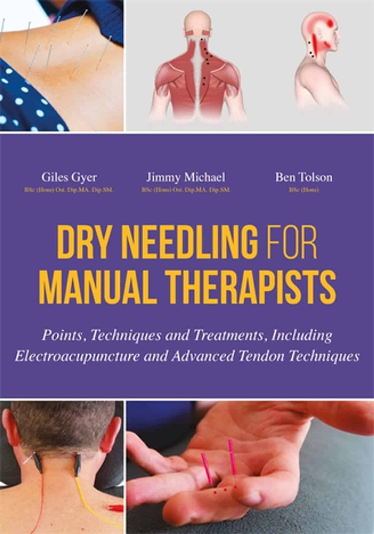 Dry needling for manual therapists - physiolair.com