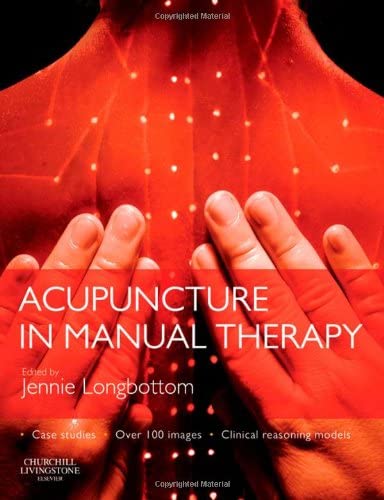 Acupuncture In Manual Therapy | Physiolair | All You Need About ...